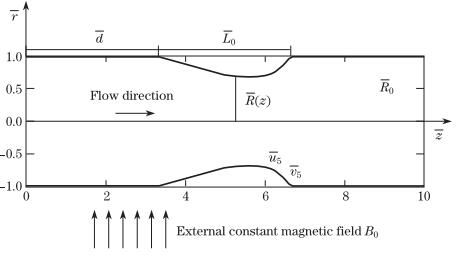 Magnetohydrodynamic approach of non-Newtonian blood flow with magnetic particles in stenosed artery