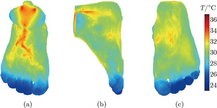 Thermogram-based estimation of foot arterial blood flow using neural ...