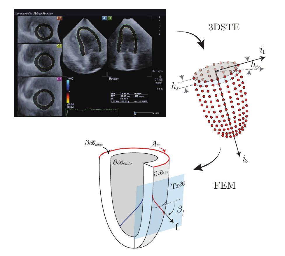Patient-specific modeling of left ventricle mechanics