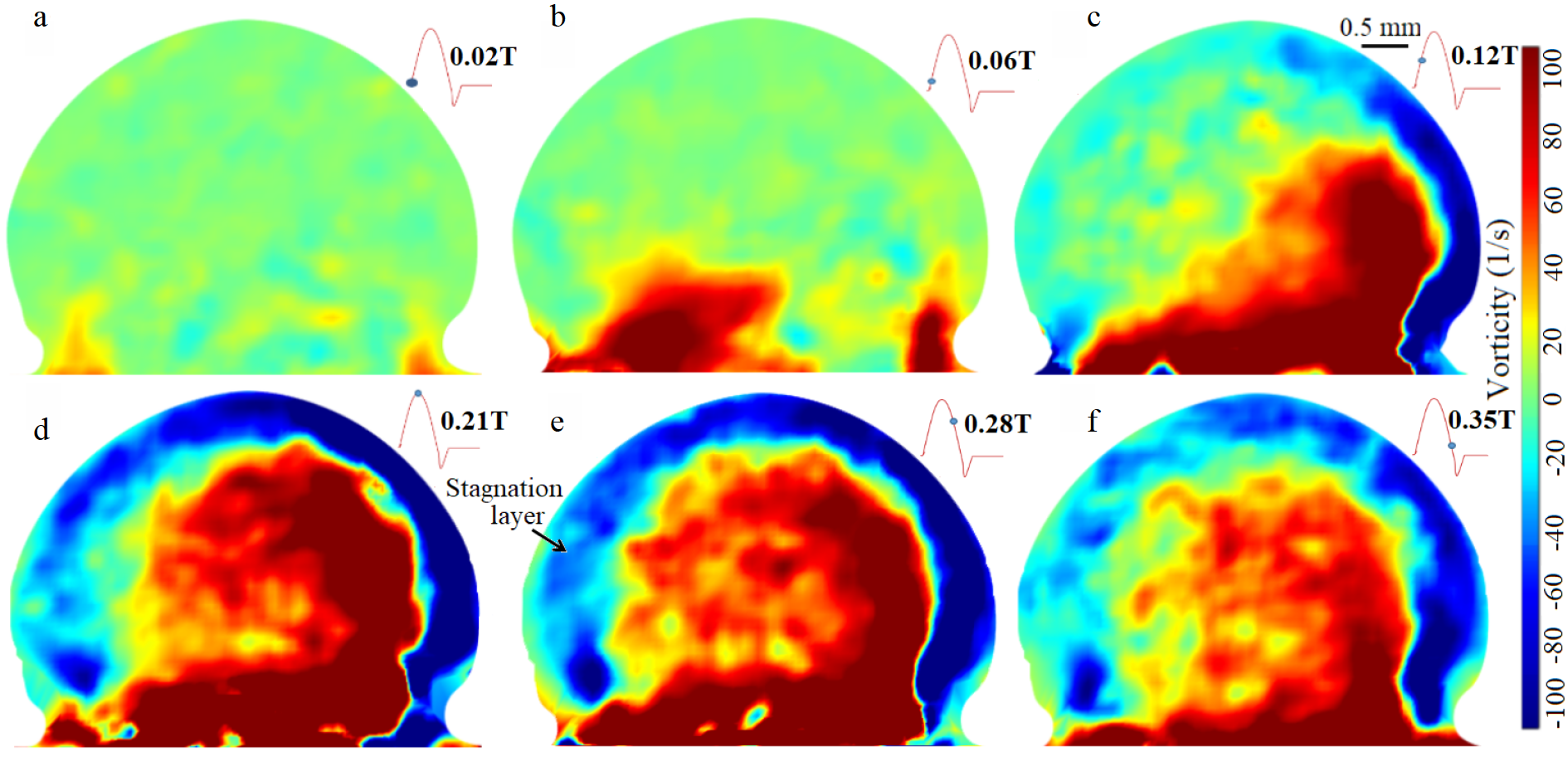 Experimental study on transient flow patterns in simplified saccular ...