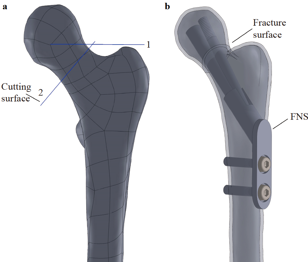 Internal fixation system with the pyramid screw head for the treatment ...
