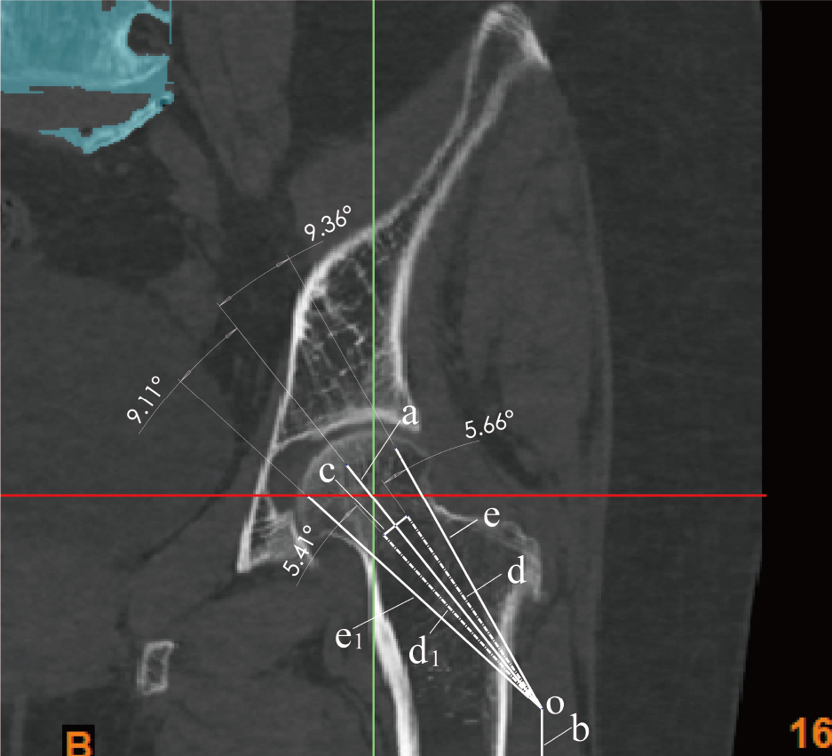 Internal fixation system with the pyramid screw head for the treatment ...