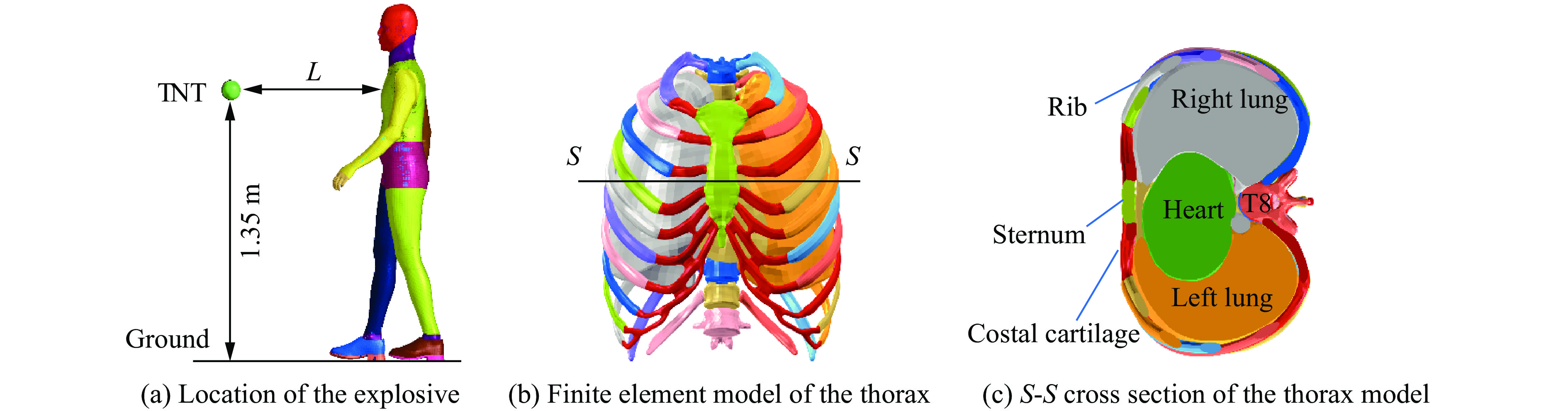 爆炸冲击波作用下人体肺部的损伤