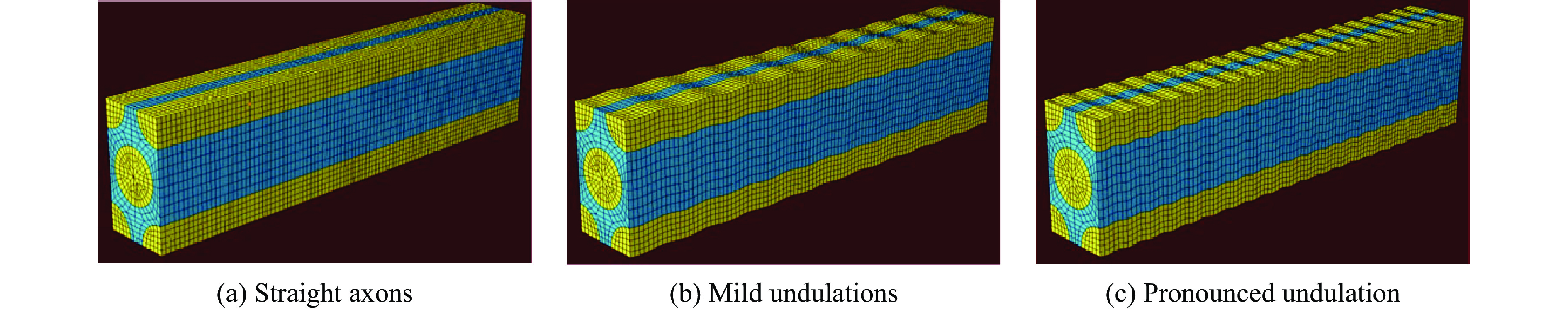 颅脑爆炸伤数值模拟研究进展：建模、力学机制及防护