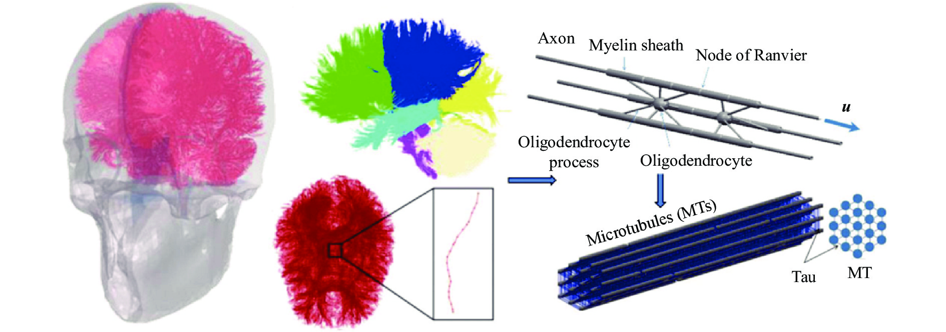 颅脑爆炸伤数值模拟研究进展：建模、力学机制及防护