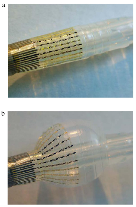 The finite deformation of the balloon catheter