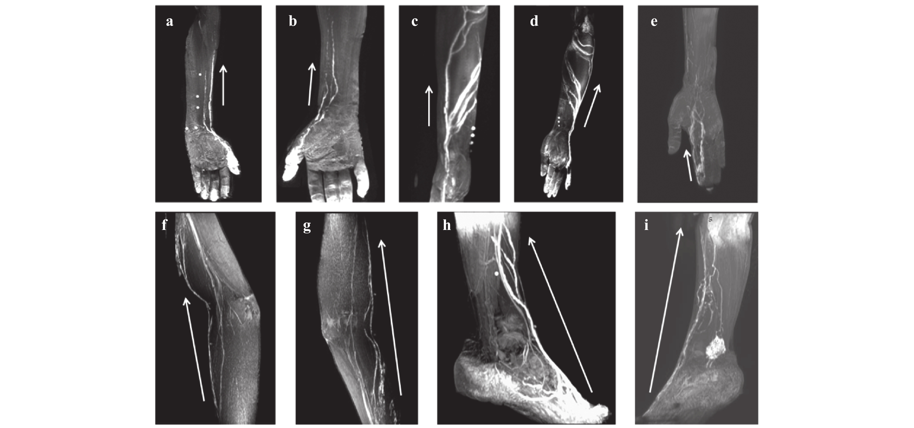 Fundamental kinematics laws of interstitial fluid flows on vascular walls