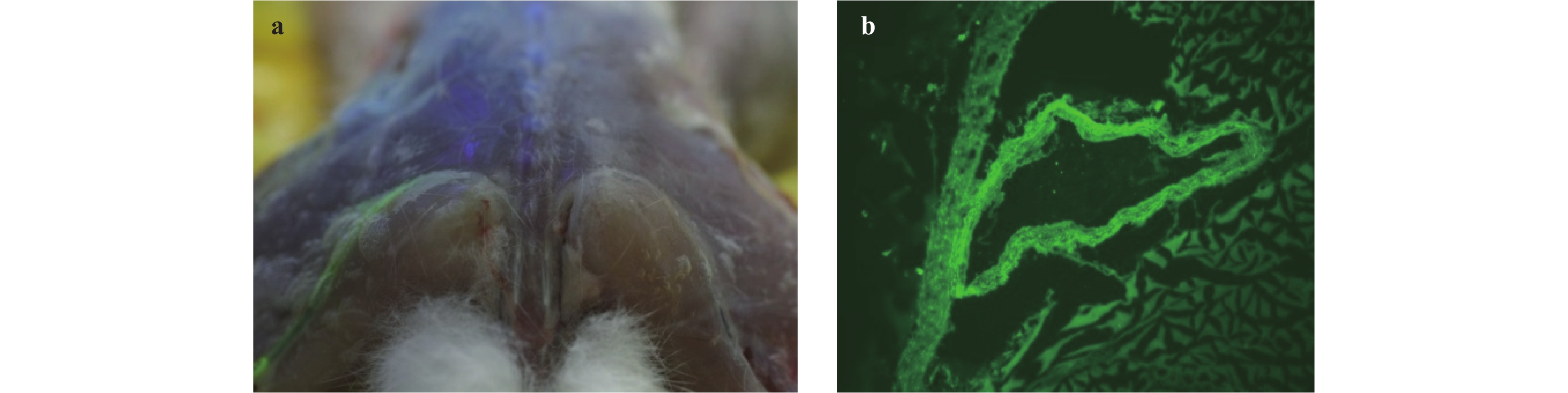 Fundamental kinematics laws of interstitial fluid flows on vascular walls